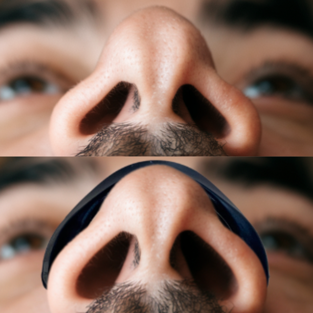 Neusholte Anatomie: Waarom de Vorm van Je Neus Je Ademhaling Beïnvloedt ...